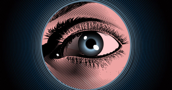 MillennialEYE | Occult Anterior Lens Subluxation